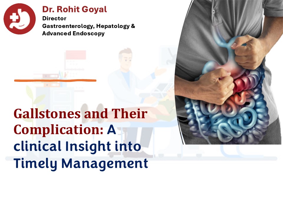 Gallstones and Their Complication: A clinical Insight into Timely Management| Gallstone ...